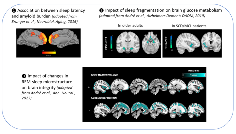 Sleep disorders - Neuropresage